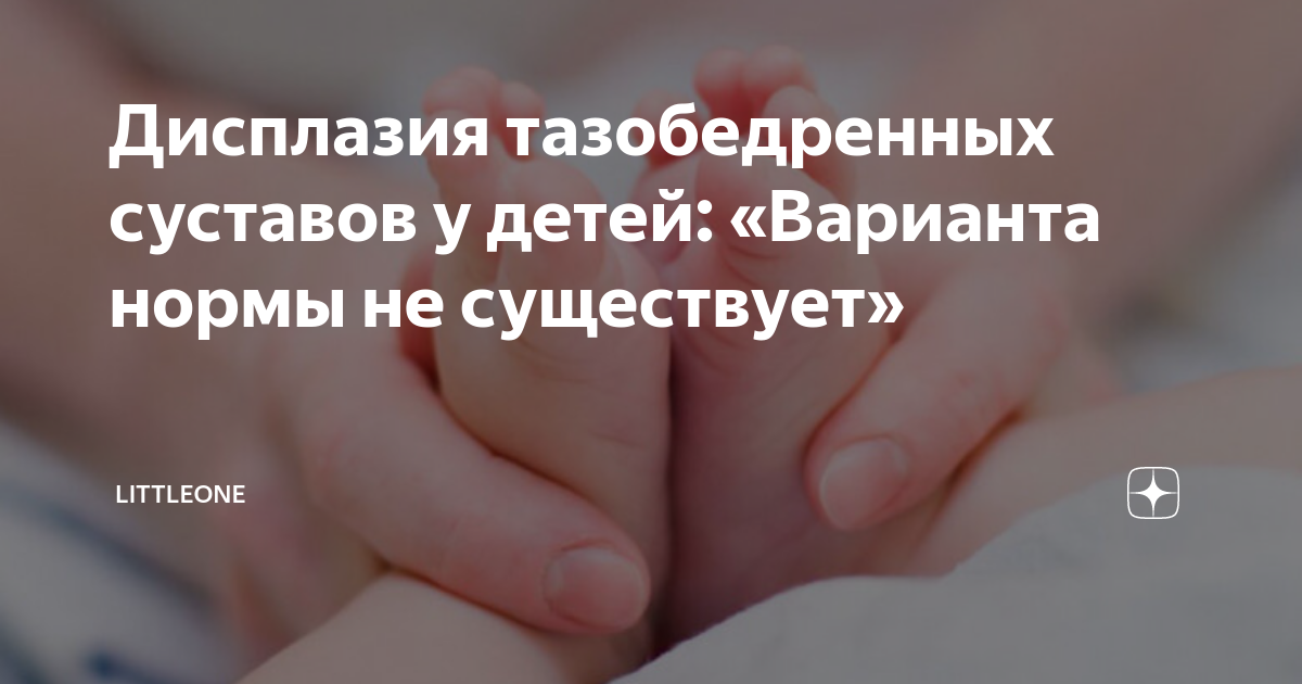 Дисплазия тазобедренных суставов у детей: «Варианта нормы не существует ...