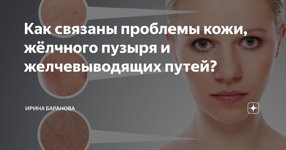 Как связаны проблемы кожи жёлчного пузыря и желчевыводящих путей