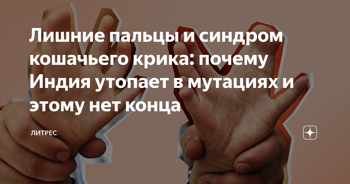 Лишние пальцы и синдром кошачьего крика: почему Индия утопает в ...