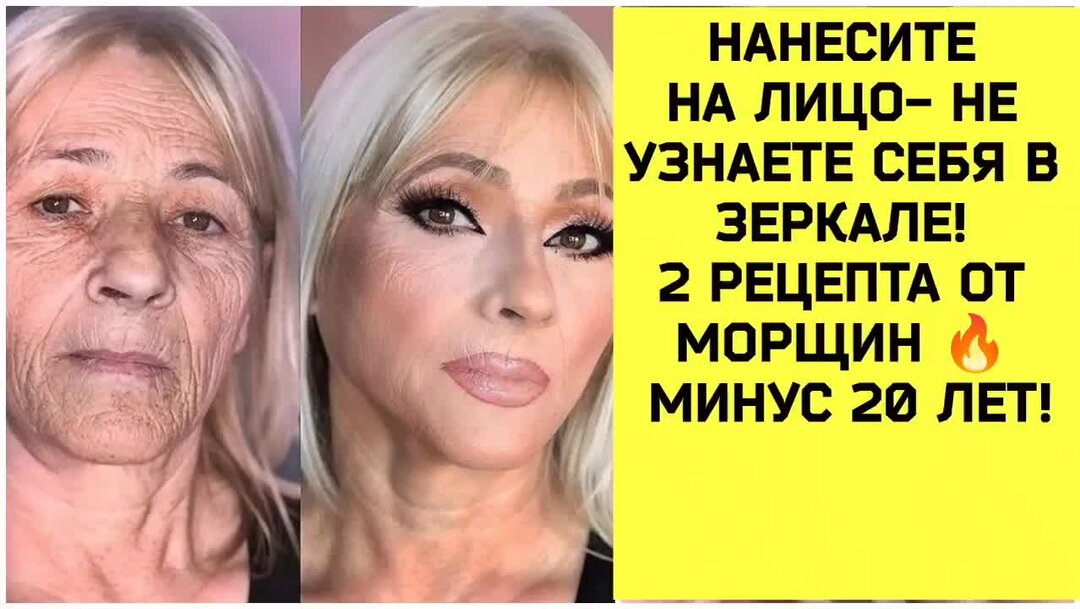 Шикарная маска заменит ПОДТЯЖКУ ОТ ГЛУБОКИХ МОРЩИН 2 РЕЦЕПТА Не Узнаете себя в зеркале