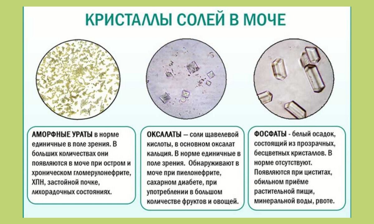 Помидоры служат причиной образования оксалатных камней в почках? | Дамы ...
