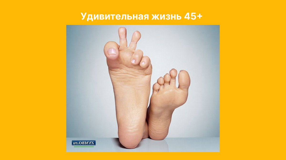 5 советов, как избавиться от косточки на большом пальце ноги ...