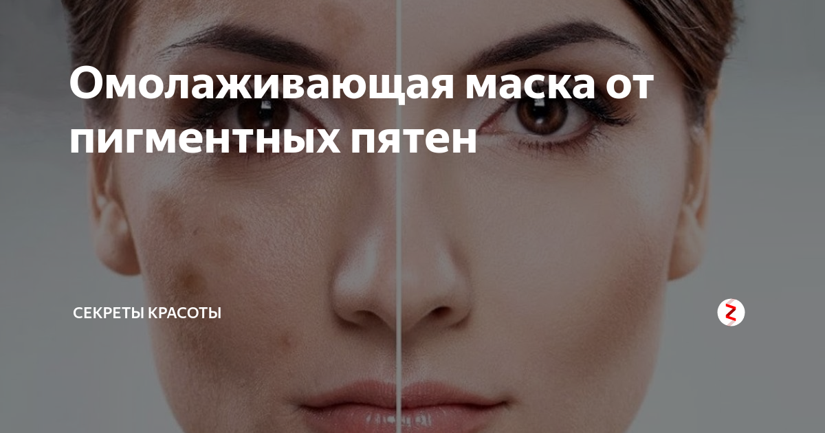 Омолаживающая маска от пигментных пятен | Секреты красоты | Дзен