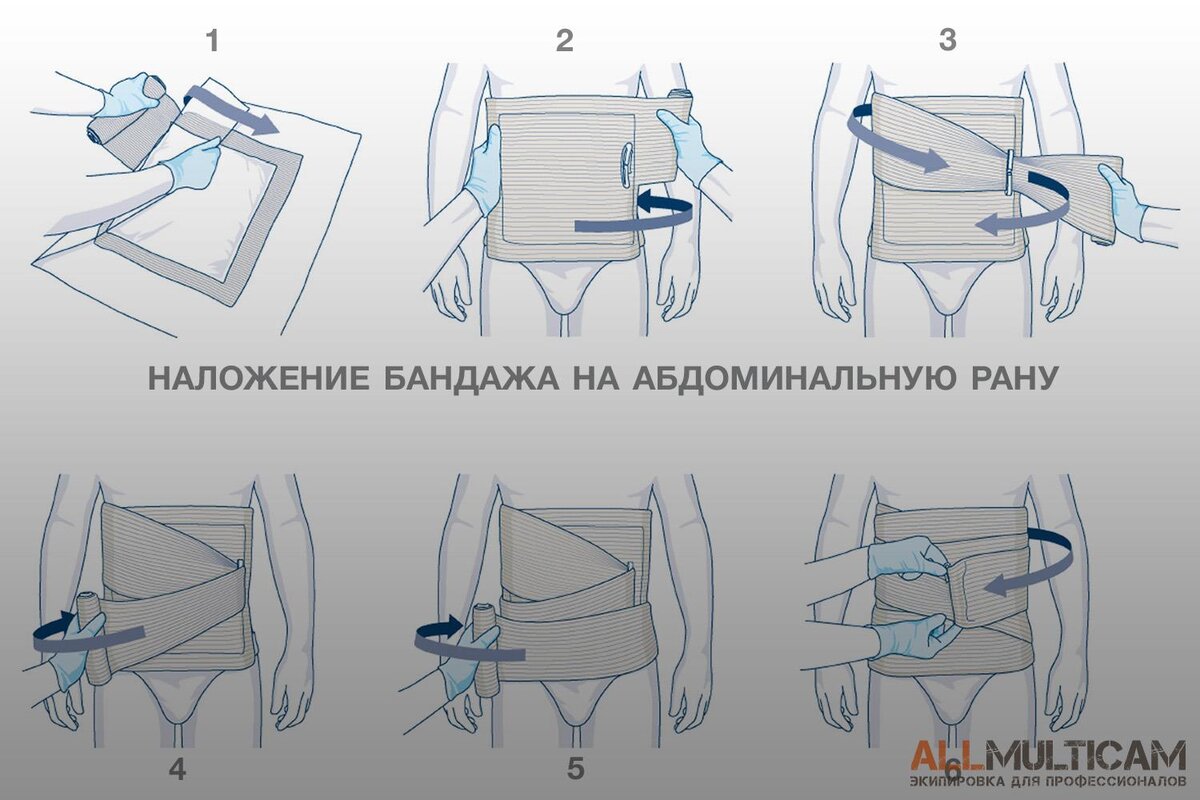 Применение израильских бандажей First Care | ALLMULTICAM | Дзен