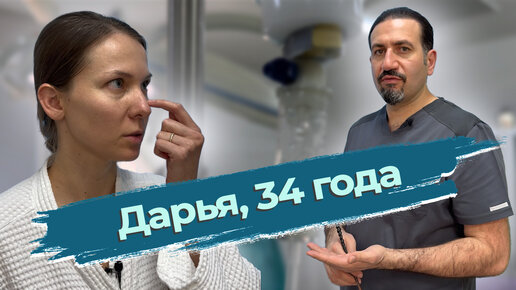 Ринопластика 👃 Дарья, 34 года | Dr.Abramian 😷 пластический хирург | Дзен