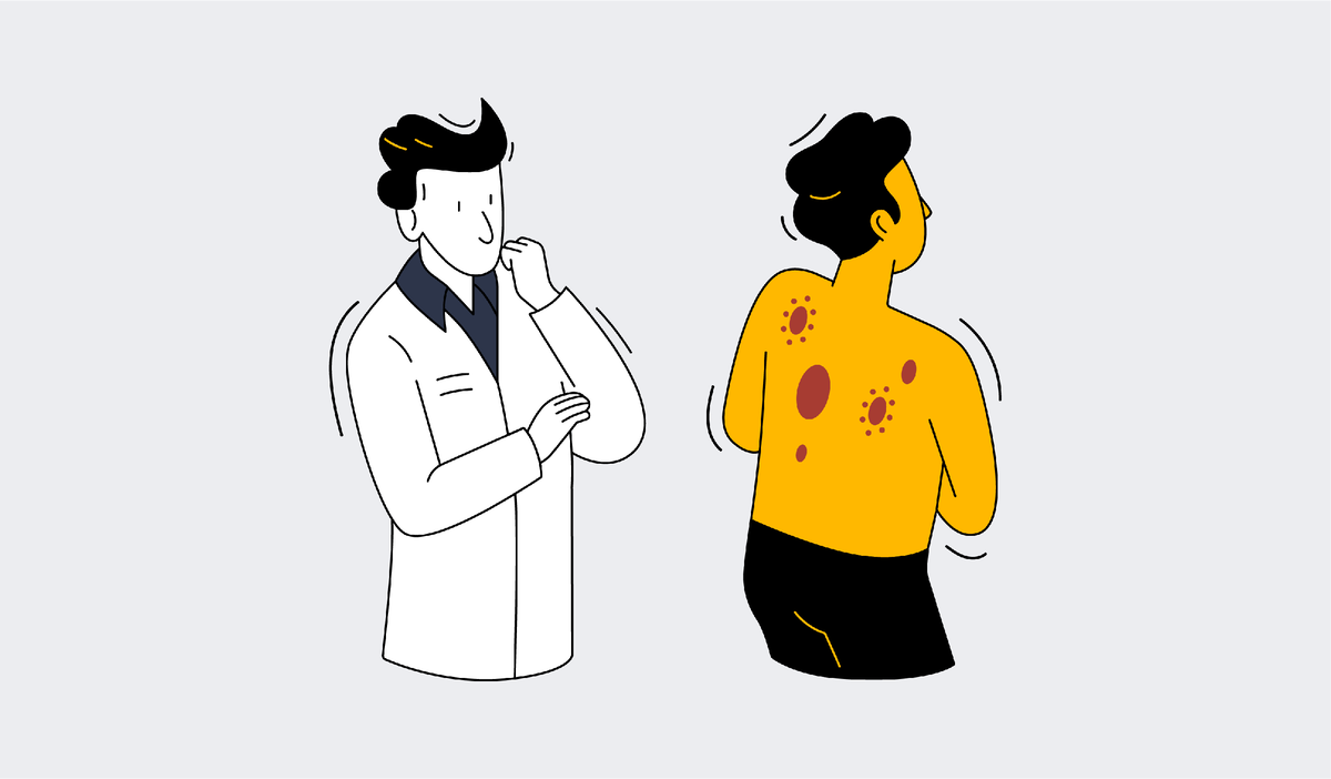 Пиритион цинка в наружном лечении псориаза | Psoriaz.Life | Дзен