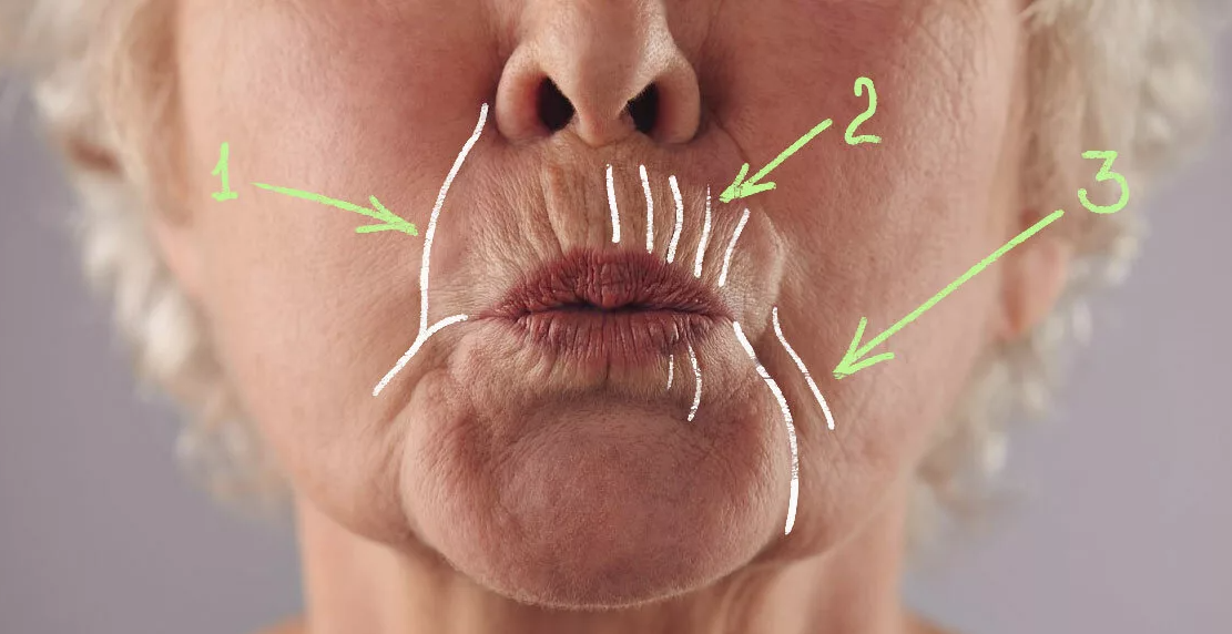 Морщины? В психосоматике причины. Как старение лица связано с работой ...