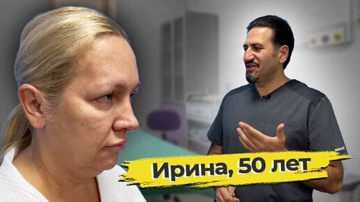 Омоложение лица: Ирина, 56 лет | Dr.Abramian 😷 пластический хирург | Дзен