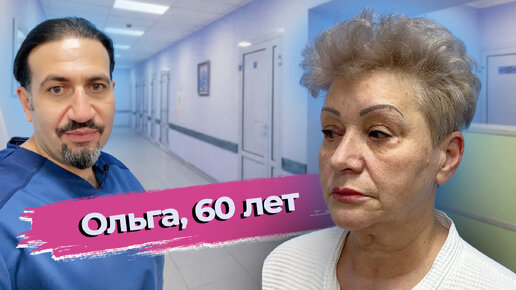 Омоложение лица: Ольга, 60 лет | Dr.Abramian 😷 пластический хирург | Дзен