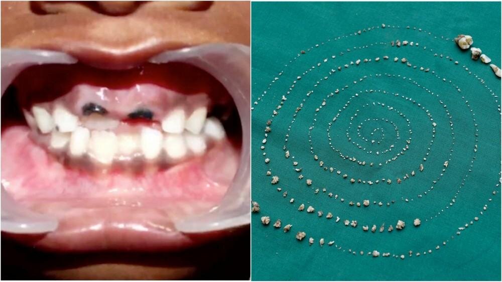 Необычные люди, в существование которых ты не поверишь. | Женя Миллер ...