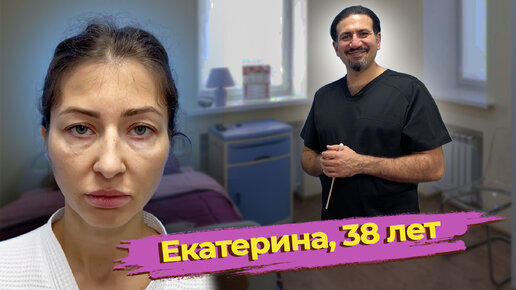 Омоложение лица; Екатерина, 38 лет | Dr.Abramian 😷 пластический хирург | Дзен