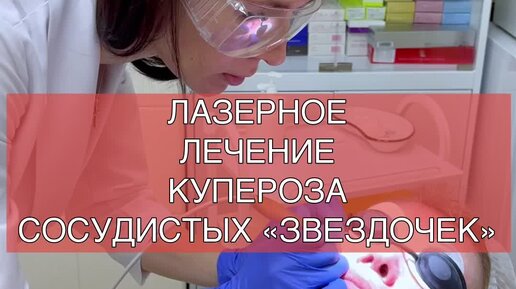 Медицинский центр ВиАнта Лазерное лечение сосудистых звездочек