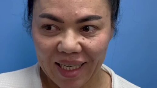 Dr.Abramian 😷 пластический хирург | Родственники шептались - какая красивая! 1 реакция и ...