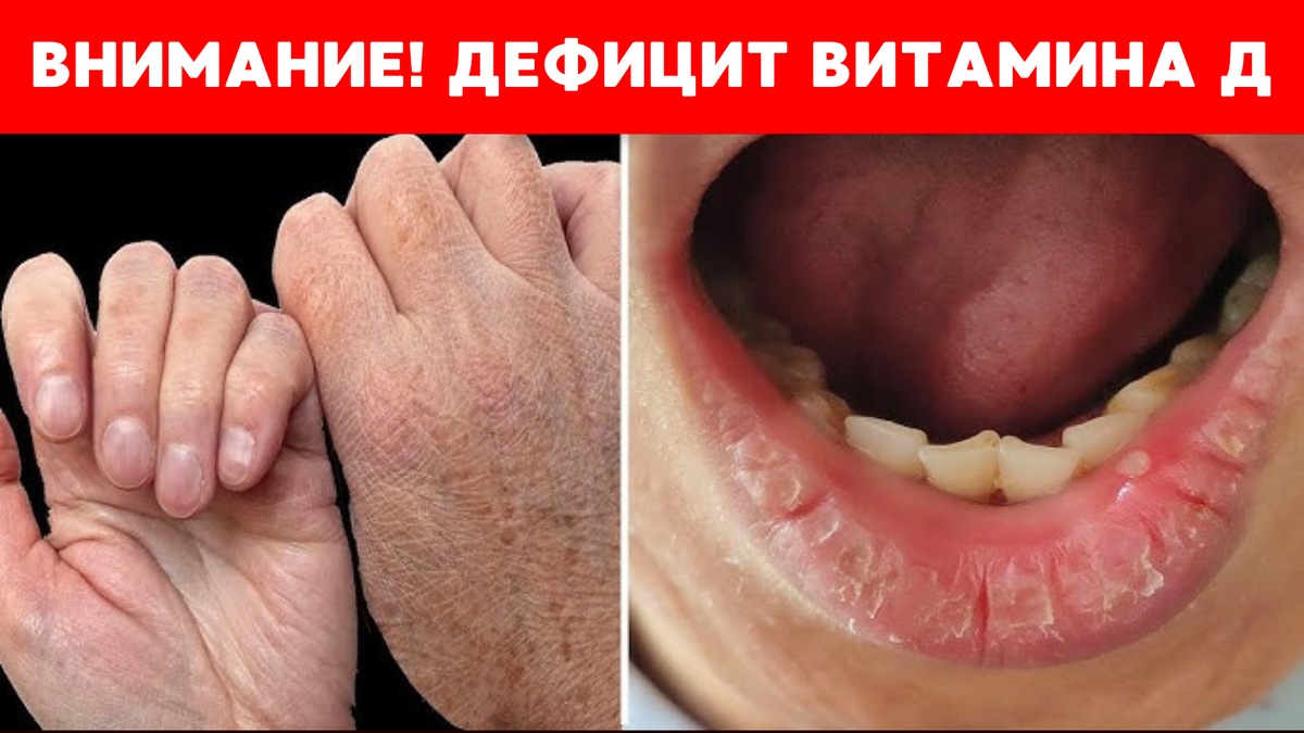 Организм предупреждает нас: 8 признаков того, что вашему телу не ...