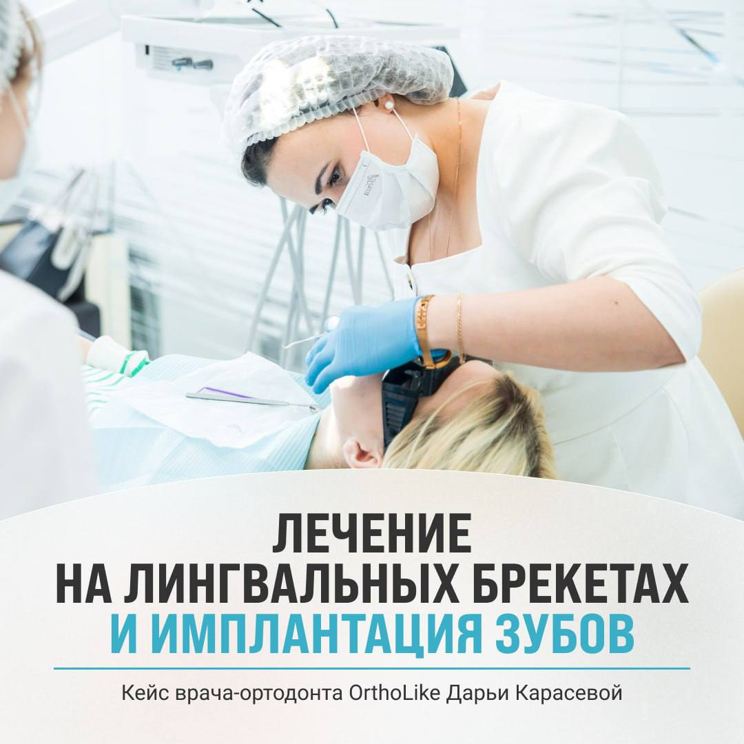 Отсутствие места для зубов и лечение на лингвальных (невидимых) брекетах. Кейс врача-ортодонта ...