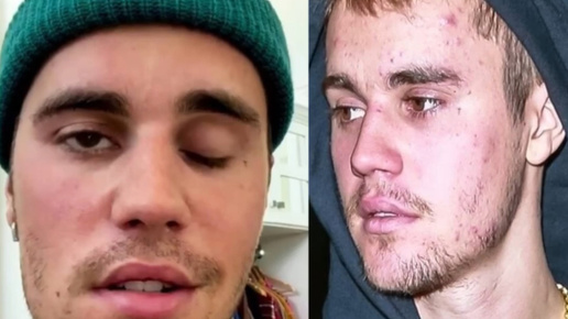 Umanchannel | ОН СЛОМАЛ ЖИЗНЬ ДЖАСТИНА БИБЕРА… | Дзен