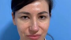 Dr.Abramian 😷 пластический хирург | Ринопластика и блефаропластика | Дзен