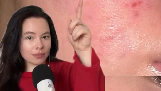 NATALIA_BBOS I уход, естественная красота, самомассаж | это не пигментация #высыпания #акне # ...