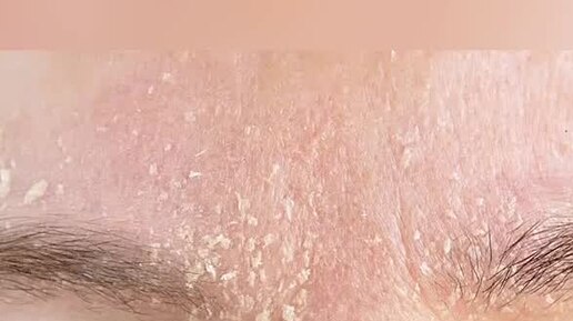 Новости косметологии | >>> Подпишись на новости косметологии https://dzen.ru/news_kosmetolog и ...