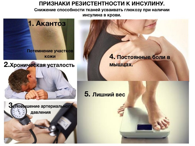 2 анализа которые помогут заметить инсулинорезистентность и риск