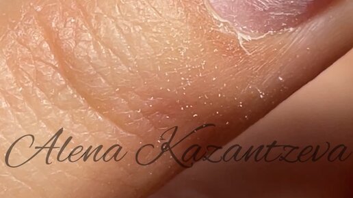 Alena.nogti.troick | срез кутикулы #кутикула #аппаратныйманикюр #ногти #маникюр #фреза | Дзен