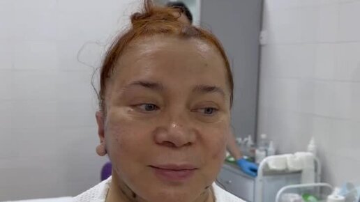 Dr.Abramian 😷 пластический хирург | Первая реакция на омоложение лица | Дзен