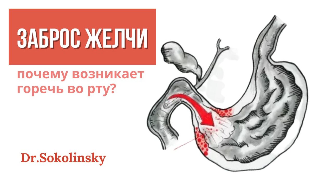 Почему бывает заброс желчи в желудок? Что делать чтобы избавиться от ...