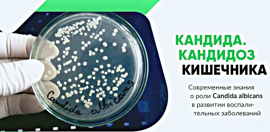 Кандид, 3 главных мифа и факта. 9 основных симптомов кандиды. Методы ...