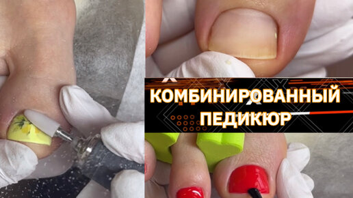 👣КОМБИНИРОВАННЫЙ ПЕДИКЮР /👣ARAVIA professional для педикюра | Татьяна ...