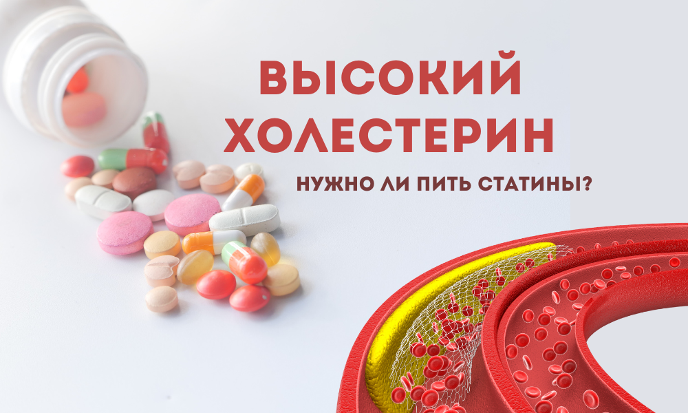 Нужно ли пить статины при высоком холестерине? | Врач-терапевт и ...